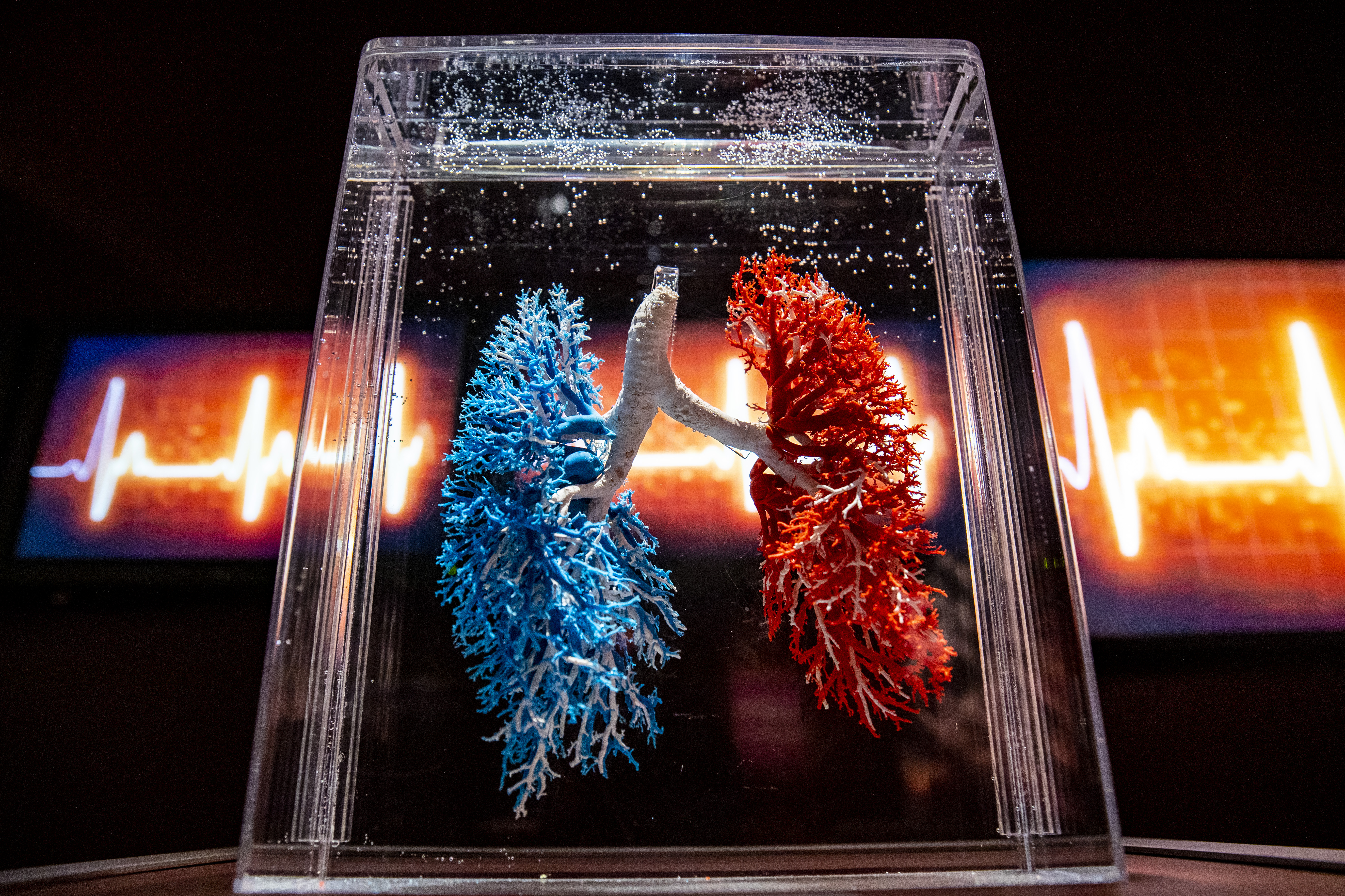 Bodies Revealed exhibit returns to Grand Rapids Public Museum - mlive.com