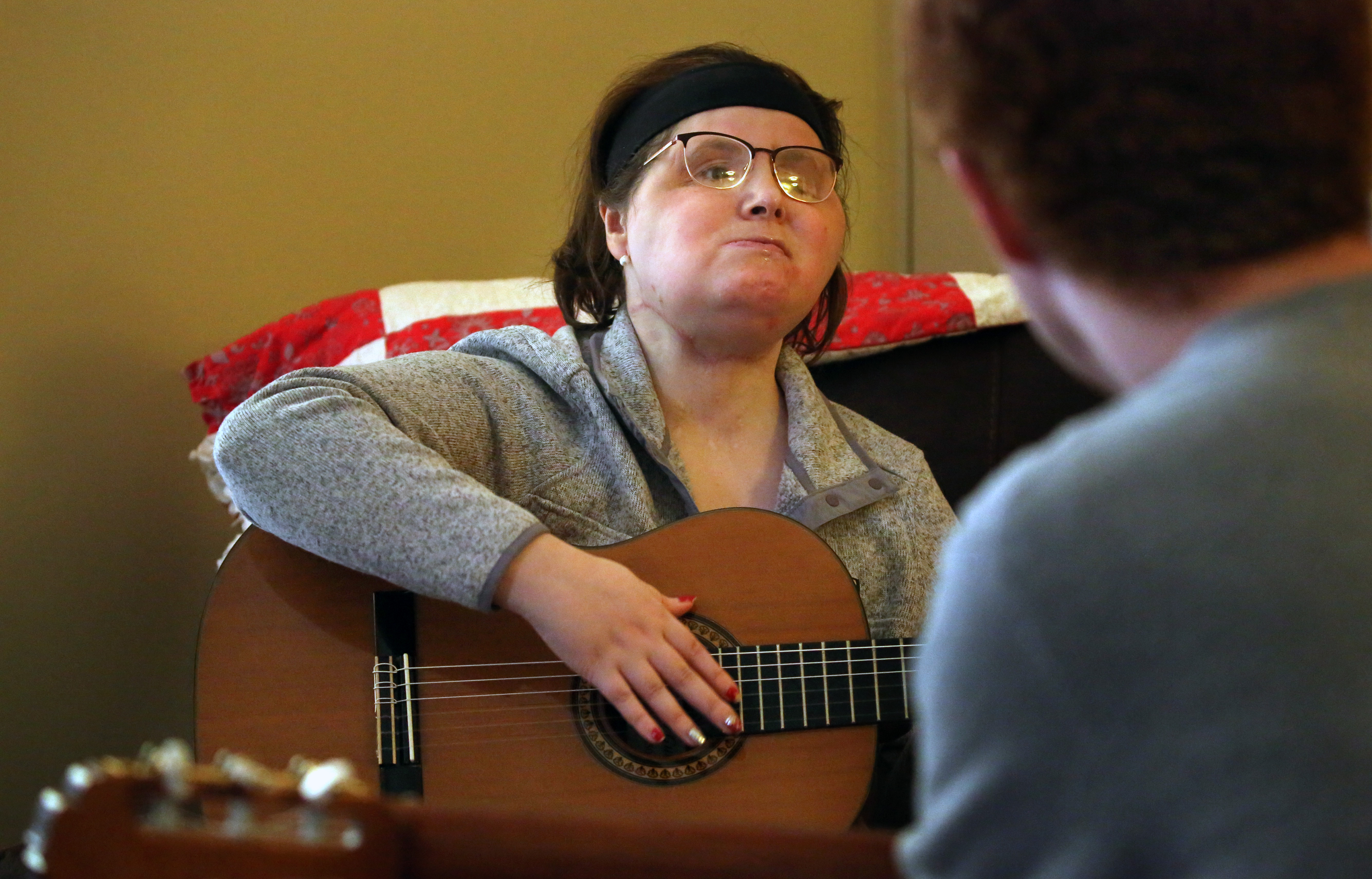 Face transplant patient to leave Ronald McDonald House - cleveland.com