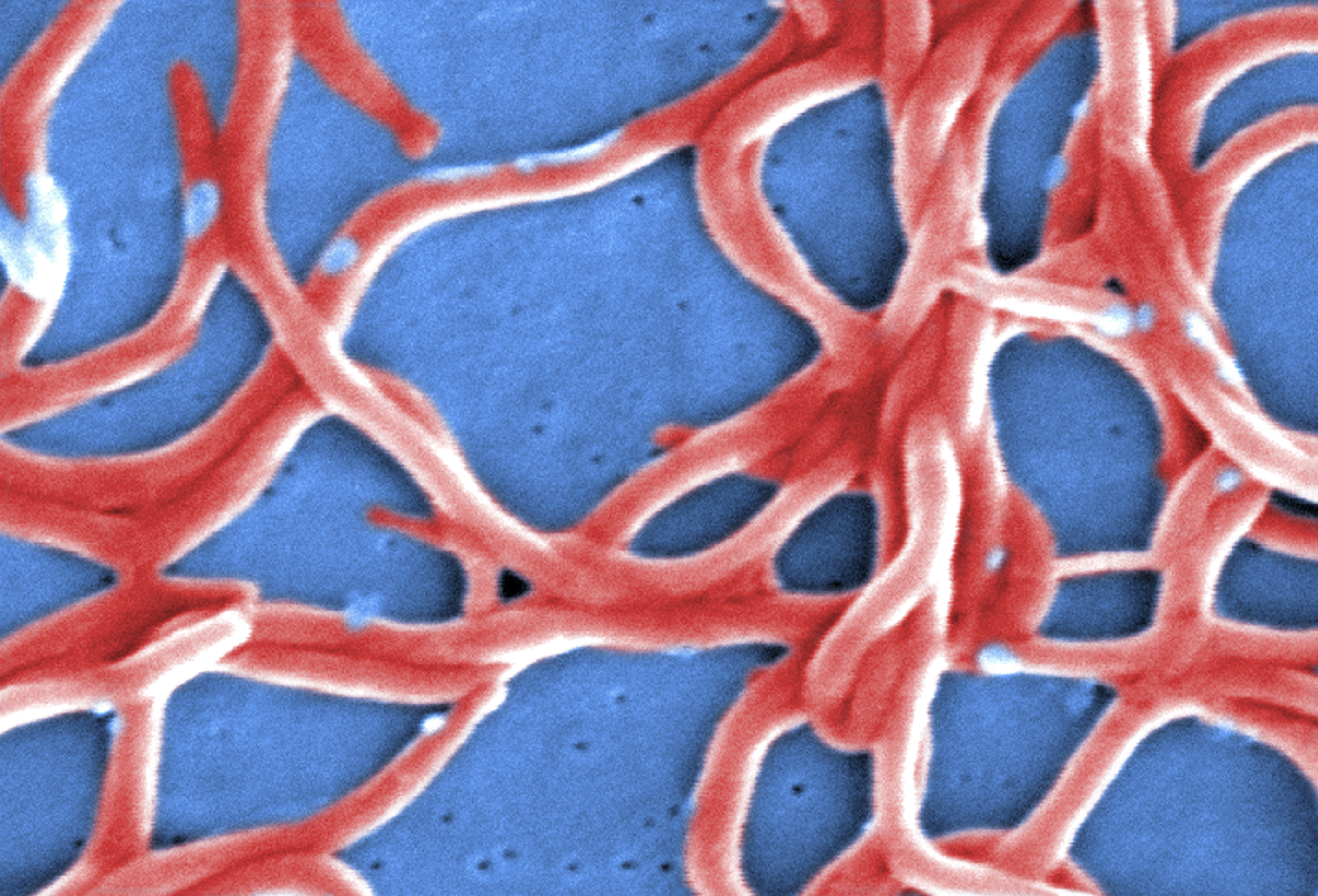 Preventing Lyme disease - cleveland.com