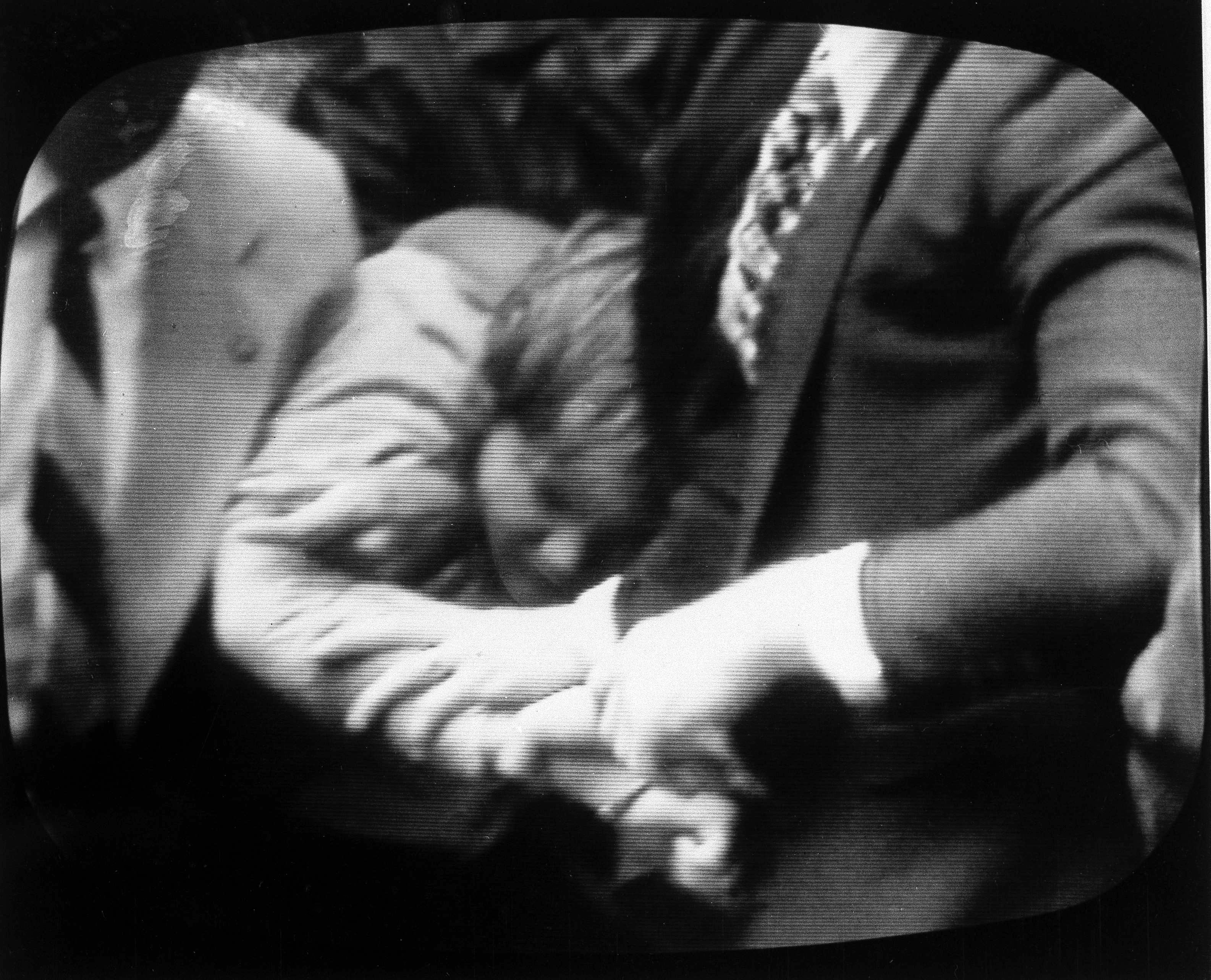 The attempted assassination of President Ronald Reagan - pennlive.com