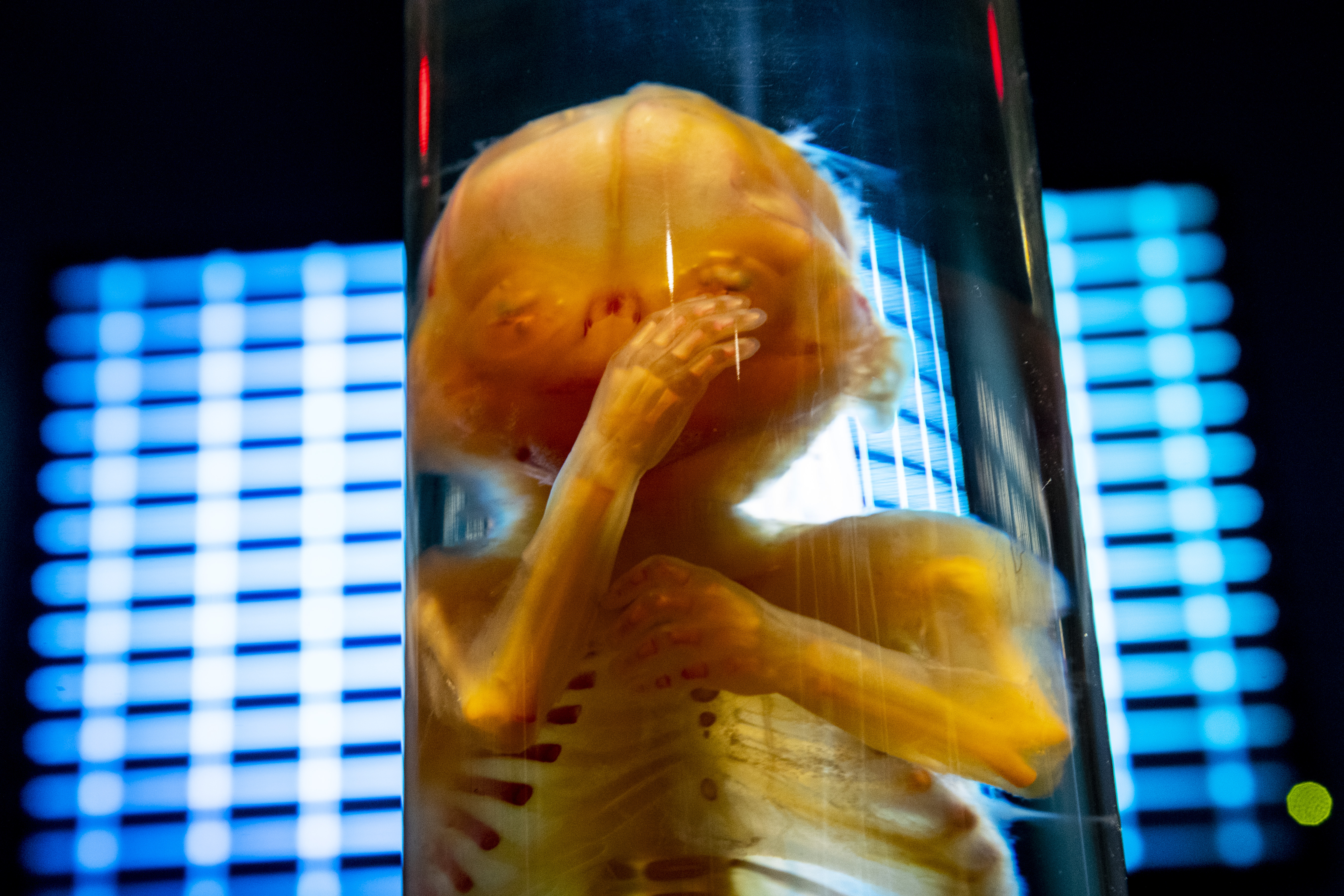 Bodies Revealed exhibit returns to Grand Rapids Public Museum - mlive.com